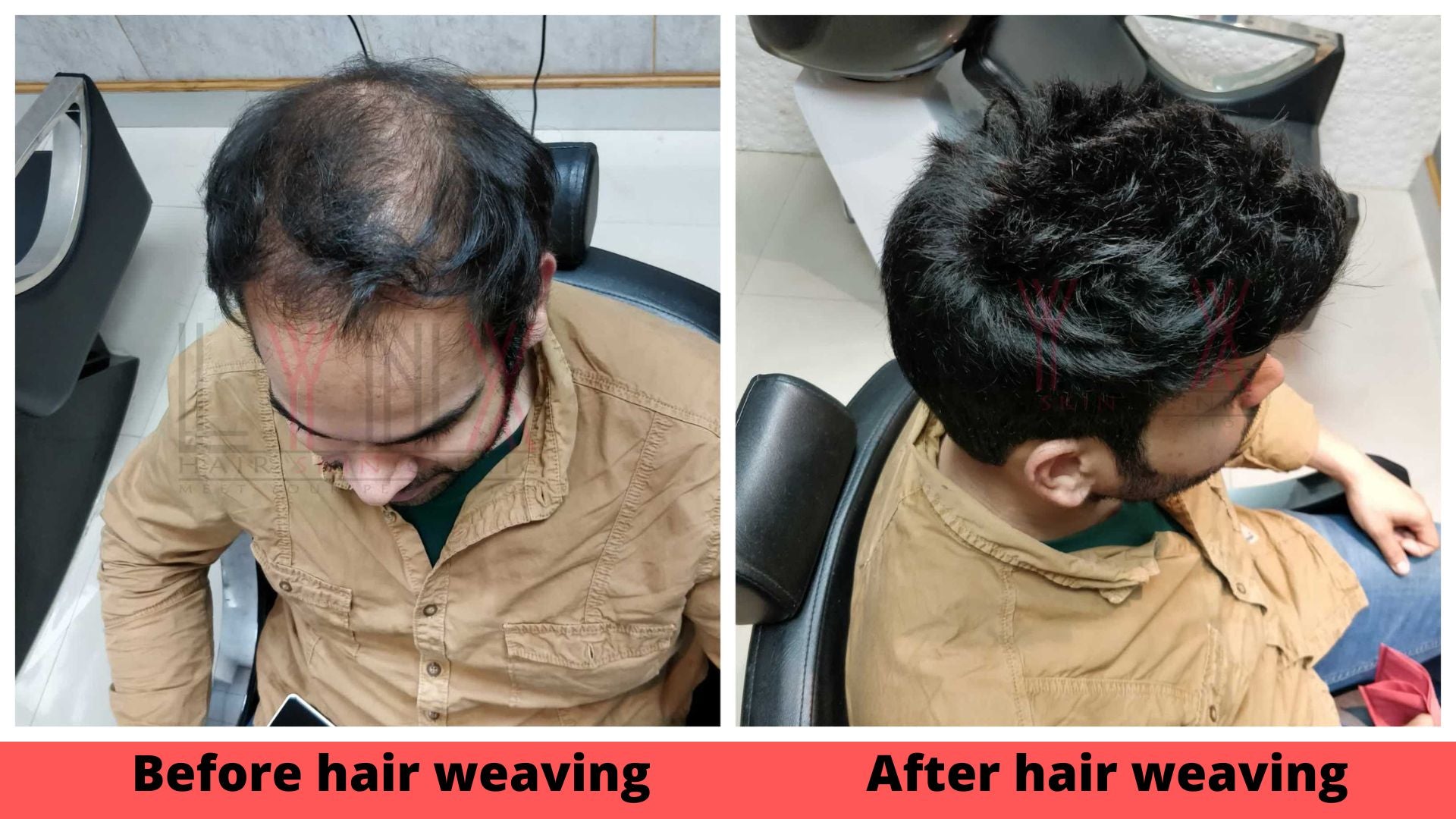 Common Issues with Hair Weaving: How to Identify and Solve Them – BALDO